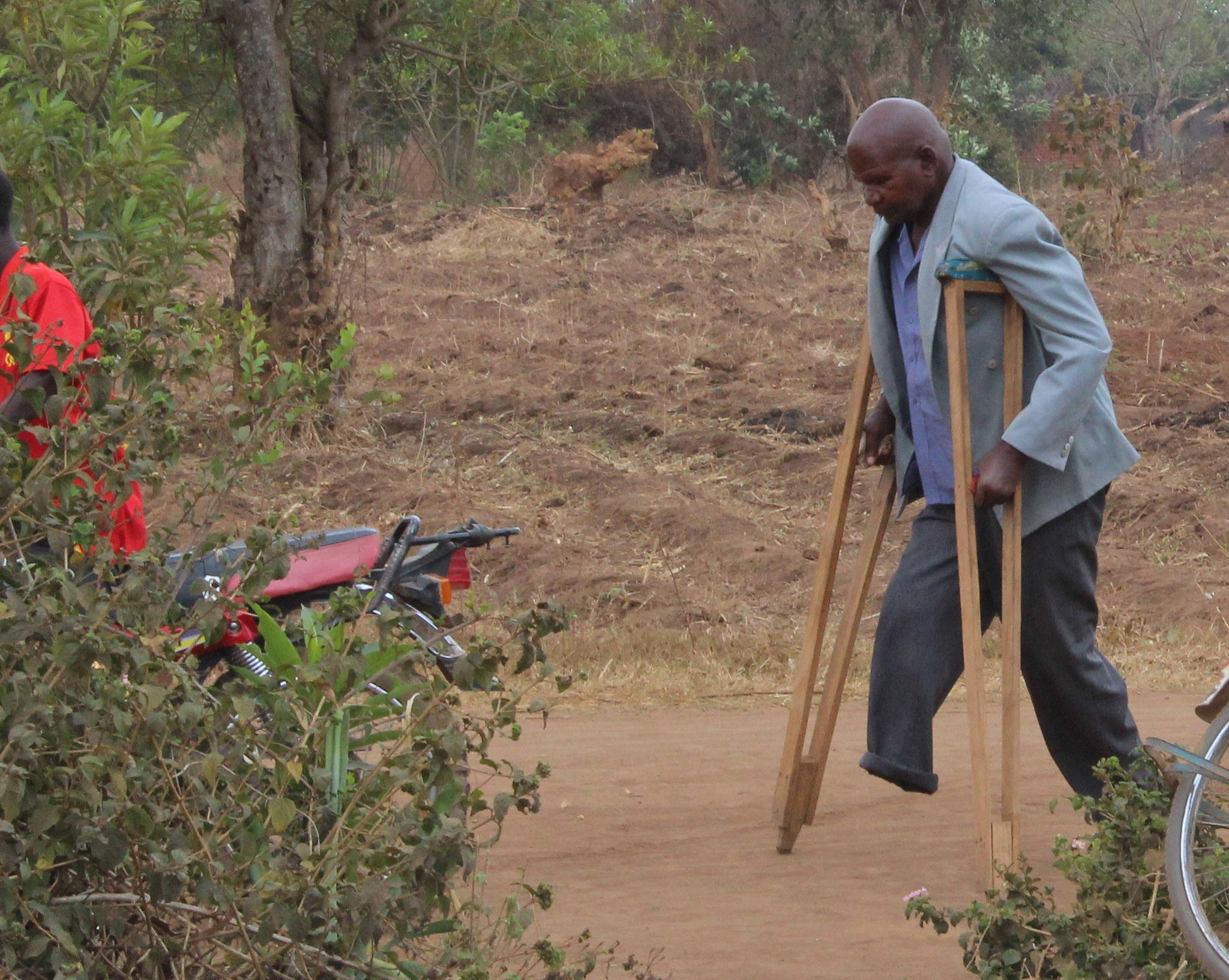 SMALL WOUND LEADS TO AMPUTATION – Malawi Project